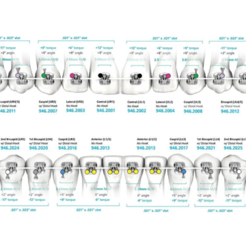 Caso de brackets Pitts 21 Orthoclassic - Orthodonca